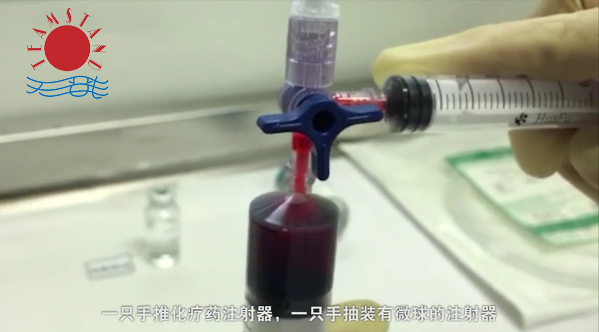 News - detailed steps about how to use embolic microspheres