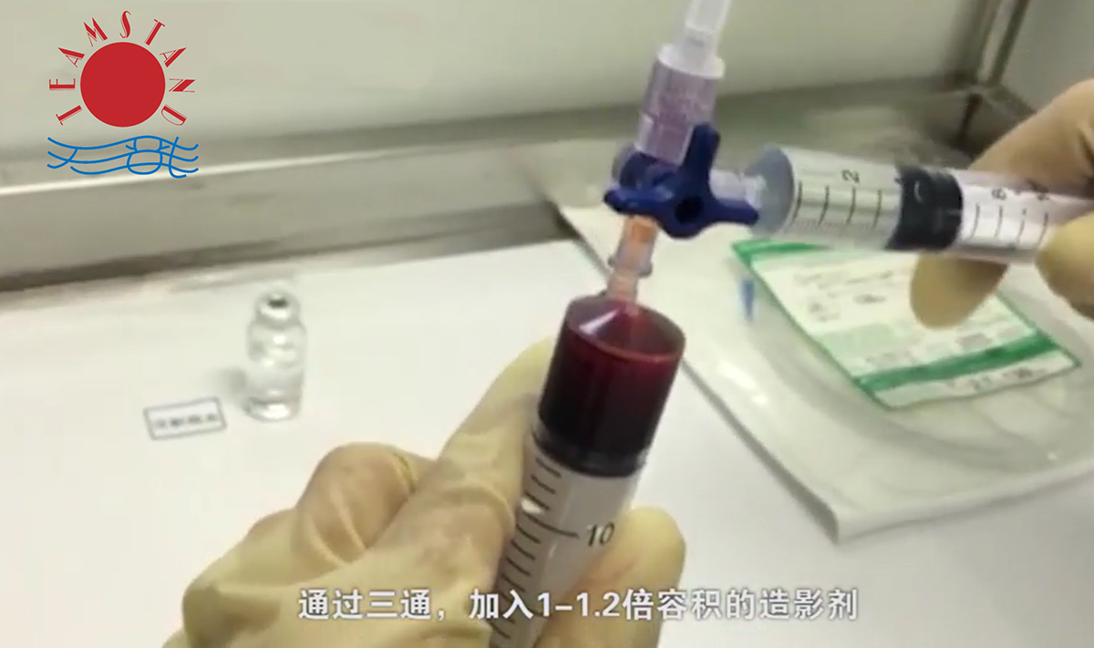 News - detailed steps about how to use embolic microspheres